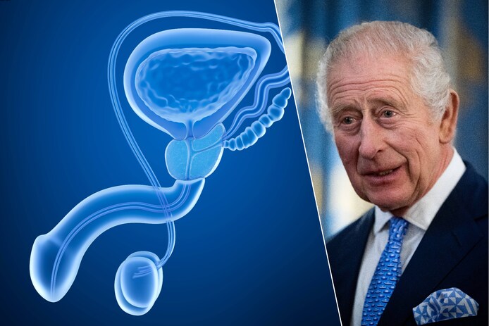 “Je kan het hebben zonder het te weten”: koning Charles heeft een ...
